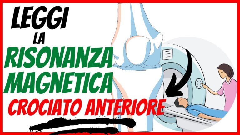 Risonanza per il Crociato Rotto: Guida Ottimizzata | Actualizado marzo 2026