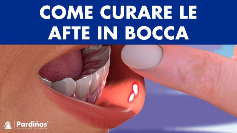 Pyralvex: Quanto tempo prima fa effetto? | Actualizado octubre 2025