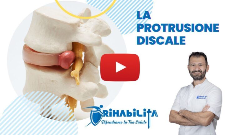 Protrusione Discale: Ampio Raggio di Trattamento | Actualizado ...