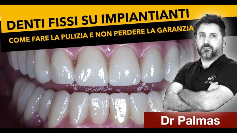 Guida completa alla pulizia dei denti: tutto ciò che devi sapere ...