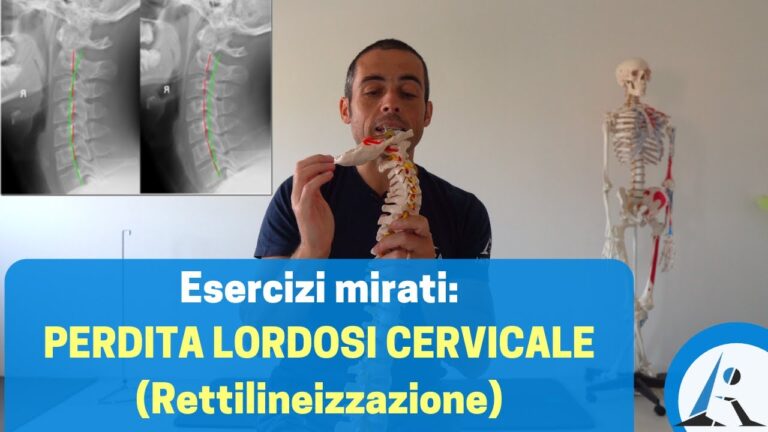 Sintomi della Lordosi Cervicale: Riconoscere e Affrontare il Problema ...
